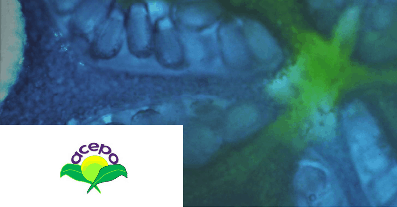 Customer Success Story Acepo - Amphasys: Single-Cell Analysis